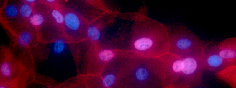 Amphasys technology analyzes cancer cells | News | Wirtschaftsförderung ...